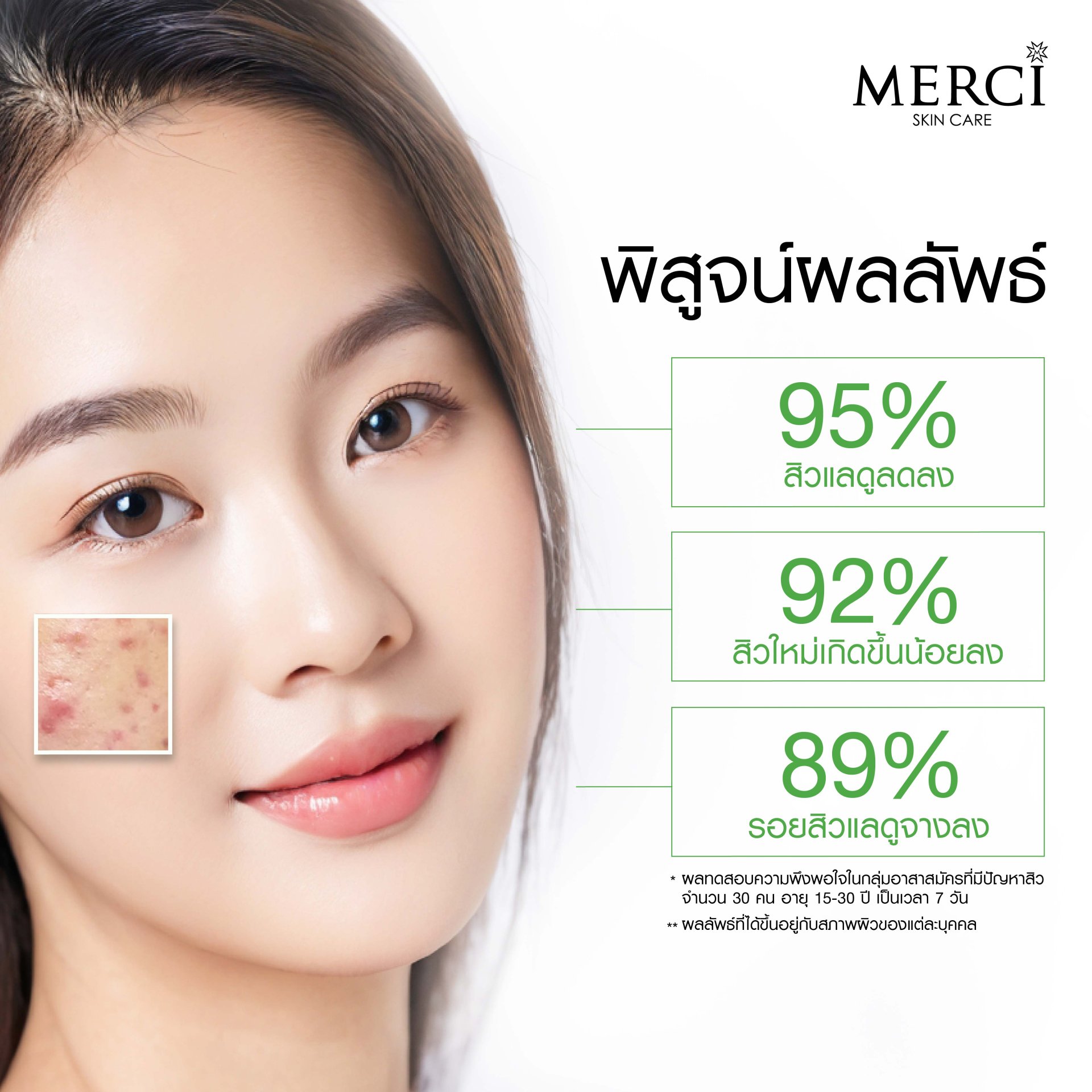 เมอร์ซี่ วิตซี สูตรลดสิว เซรั่มลดสิว เมอร์ซี่
